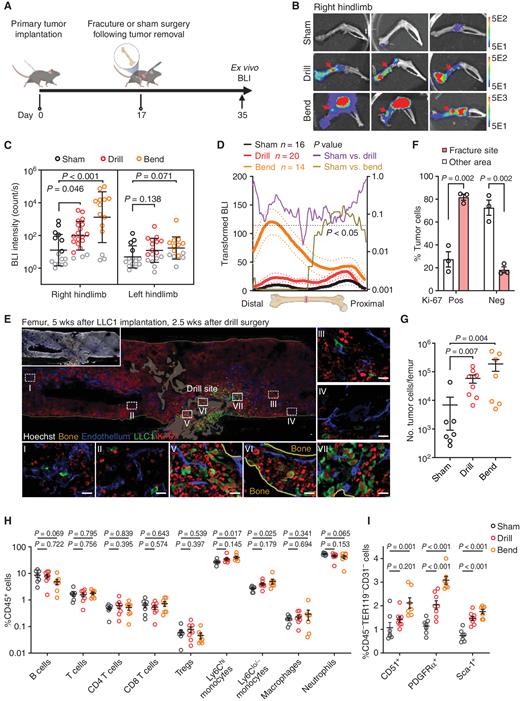 Bone Metastasis Initiation Is Coupled with Bone Remodeling through ...