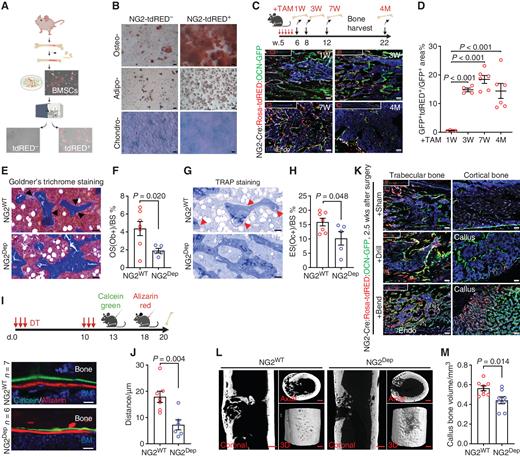 Bone Metastasis Initiation Is Coupled with Bone Remodeling through ...