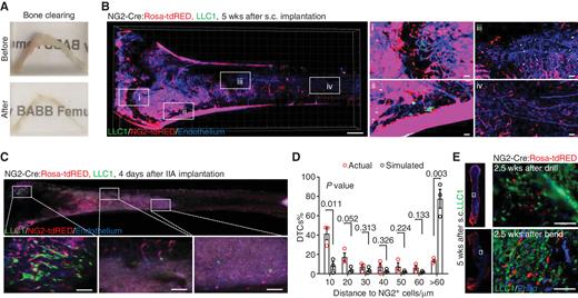 Bone Metastasis Initiation Is Coupled with Bone Remodeling through ...
