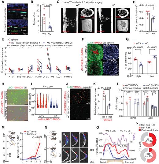 Bone Metastasis Initiation Is Coupled with Bone Remodeling through ...