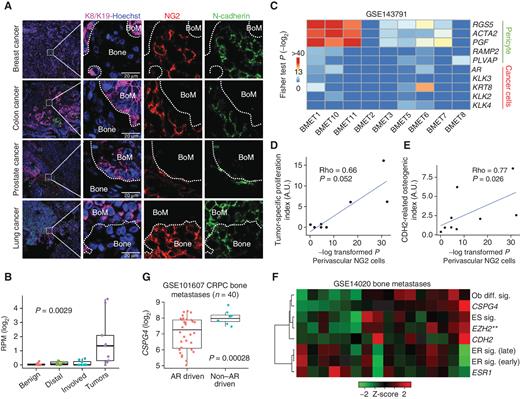 Bone Metastasis Initiation Is Coupled with Bone Remodeling through ...