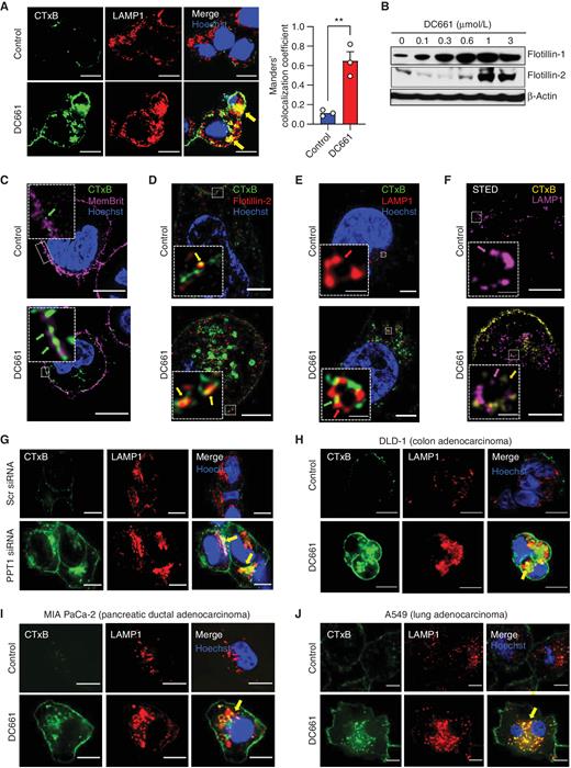 Targeting UGCG Overcomes Resistance to Lysosomal Autophagy Inhibition ...