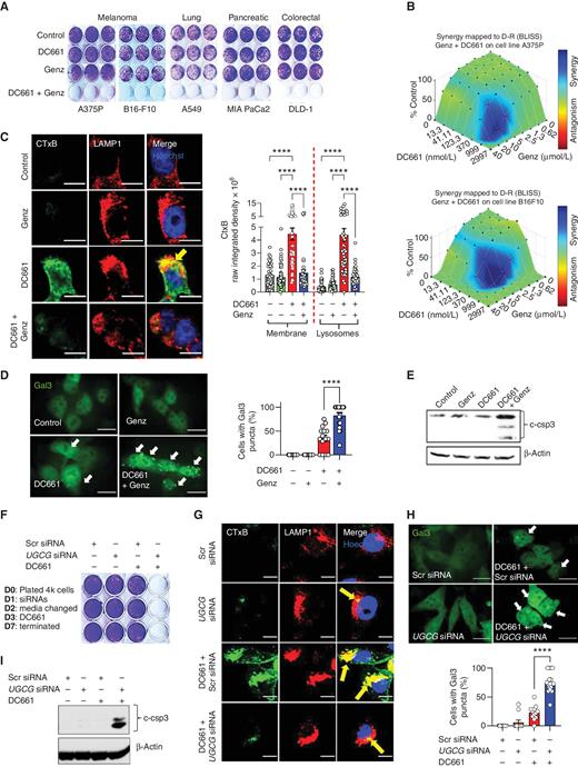 Targeting UGCG Overcomes Resistance to Lysosomal Autophagy Inhibition ...