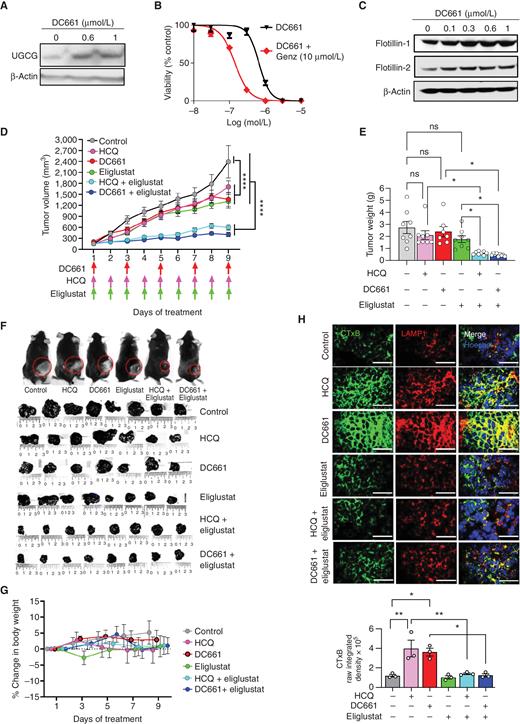 Targeting UGCG Overcomes Resistance to Lysosomal Autophagy Inhibition ...