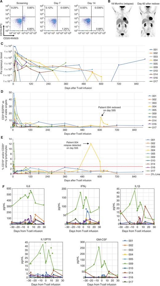 CD19/CD20 Bispecific Chimeric Antigen Receptor (CAR) in Naive/Memory T ...