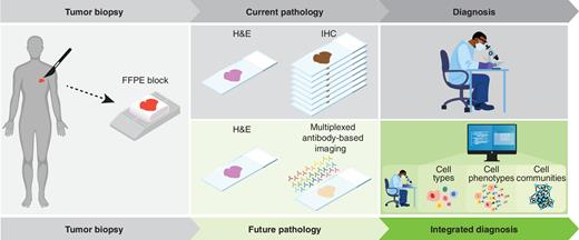 Moving Spatially Resolved Multiplexed Protein Profiling toward Clinical Oncology | Cancer ...