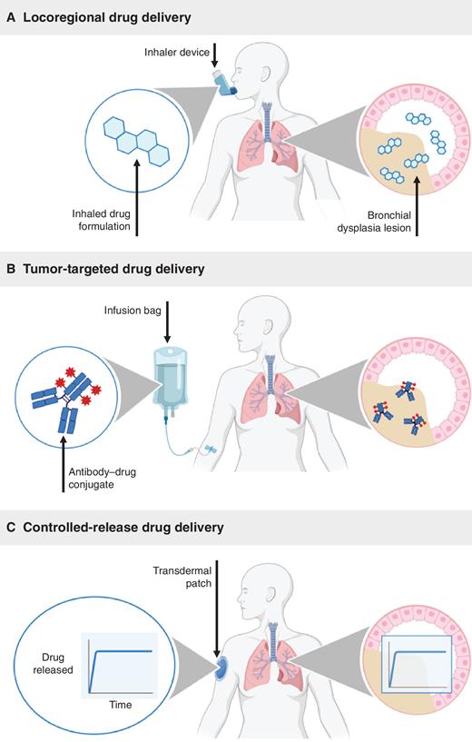 A View on Drug Development for Cancer Prevention | Cancer Discovery ...