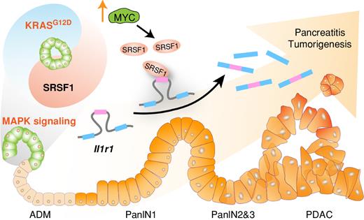 Splicing Factor SRSF1 Promotes Pancreatitis and KRASG12D-Mediated ...