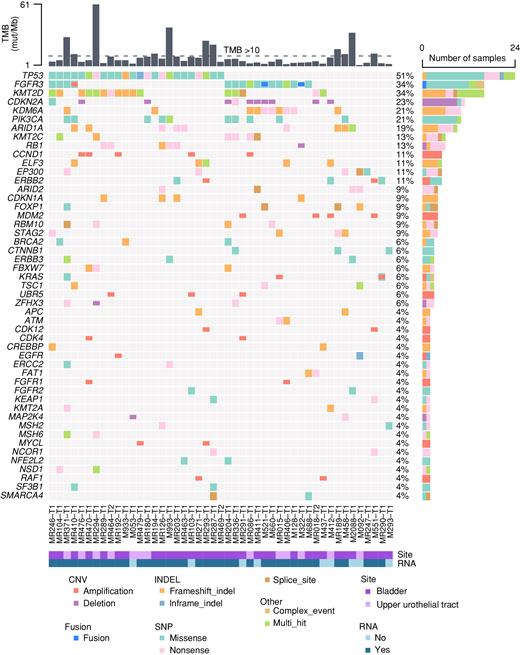 Resistance to Selective FGFR Inhibitors in FGFR-Driven Urothelial ...