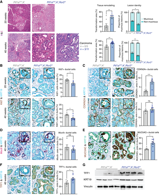 ROR2 Regulates Cellular Plasticity in Pancreatic Neoplasia and ...