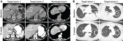 Translational and Therapeutic Evaluation of RAS-GTP Inhibition by RMC ...