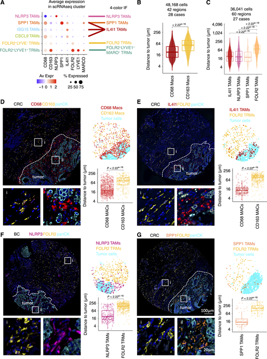 Spatially Segregated Macrophage Populations Predict Distinct Outcomes ...