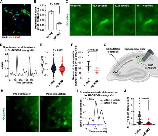 CHD2 Regulates Neuron–Glioma Interactions in Pediatric Glioma | Cancer ...