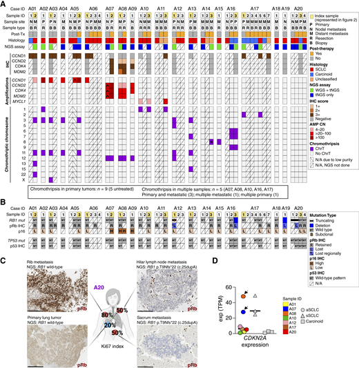 Chromothripsis-Mediated Small Cell Lung Carcinoma | Cancer Discovery ...