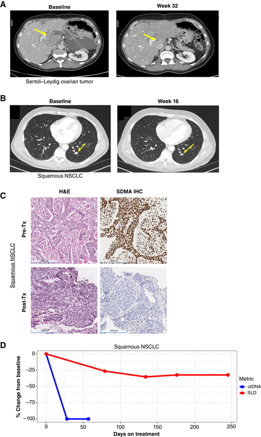 AMG 193, a Clinical Stage MTA-Cooperative PRMT5 Inhibitor, Drives ...