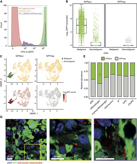 Glioblastoma Cortical Organoids Recapitulate Cell-State Heterogeneity ...