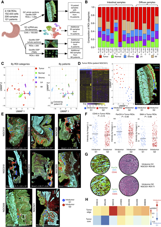 Spatially Resolved Tumor Ecosystems and Cell States in Gastric ...