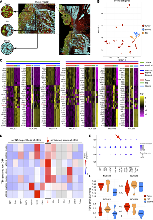 Spatially Resolved Tumor Ecosystems and Cell States in Gastric ...