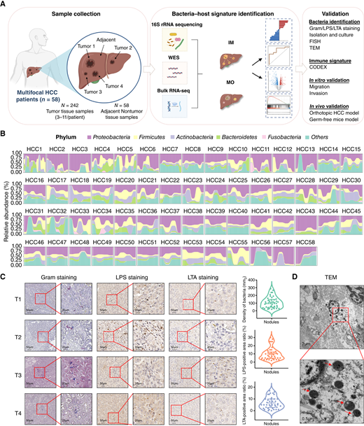 Intrahepatic Microbial Heterogeneity in Multifocal Hepatocellular ...