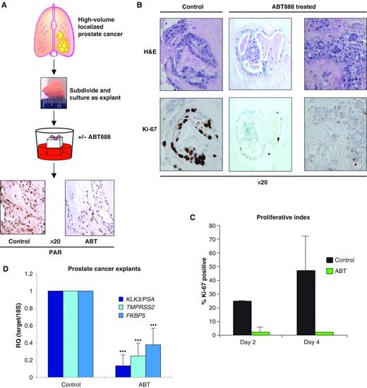 Dual Roles of PARP-1 Promote Cancer Growth and Progression | Cancer ...