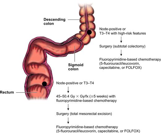 Cancers of the Colon and Rectum: Identical or Fraternal Twins? | Cancer ...