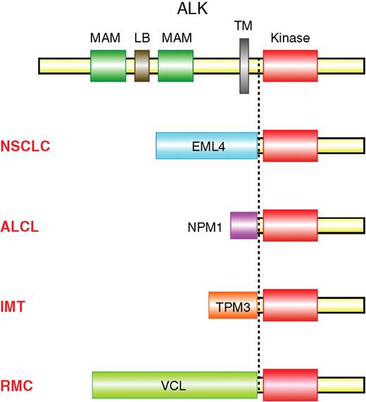 ALKoma: A Cancer Subtype with a Shared Target | Cancer Discovery ...