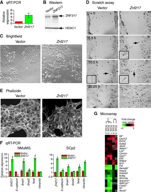 The Transcription Factor ZNF217 Is a Prognostic Biomarker and ...