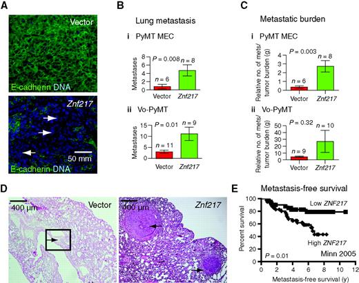 The Transcription Factor ZNF217 Is a Prognostic Biomarker and ...