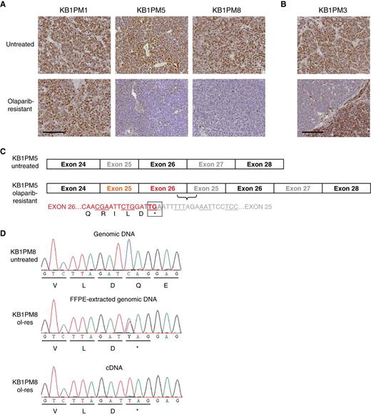 Loss of 53BP1 Causes PARP Inhibitor Resistance in Brca1-Mutated Mouse ...