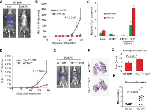 Bone Marrow–Derived Gr1+ Cells Can Generate a Metastasis-Resistant ...