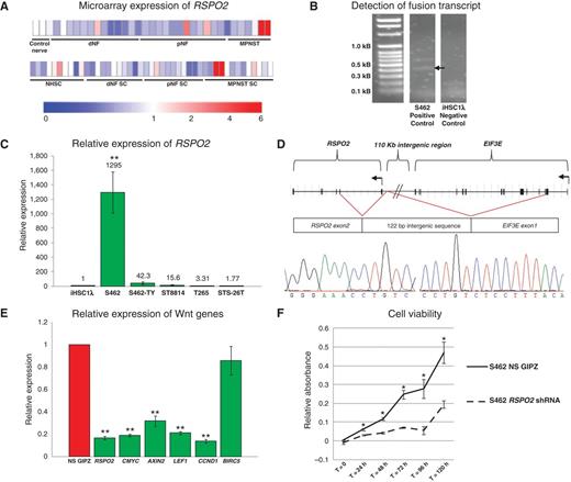 Canonical Wnt/β-catenin Signaling Drives Human Schwann Cell ...