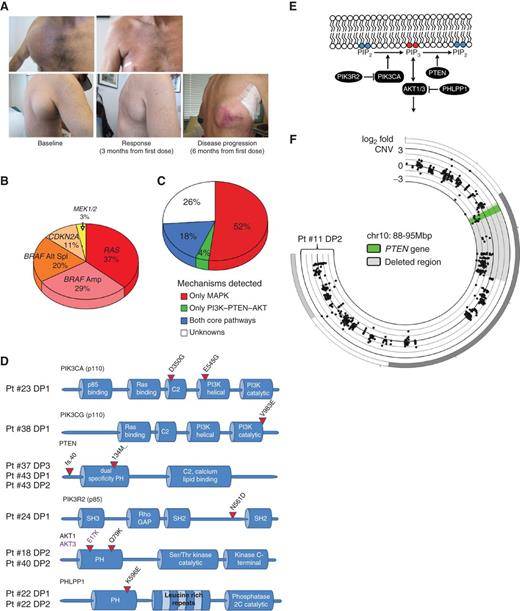 Acquired Resistance and Clonal Evolution in Melanoma during BRAF ...