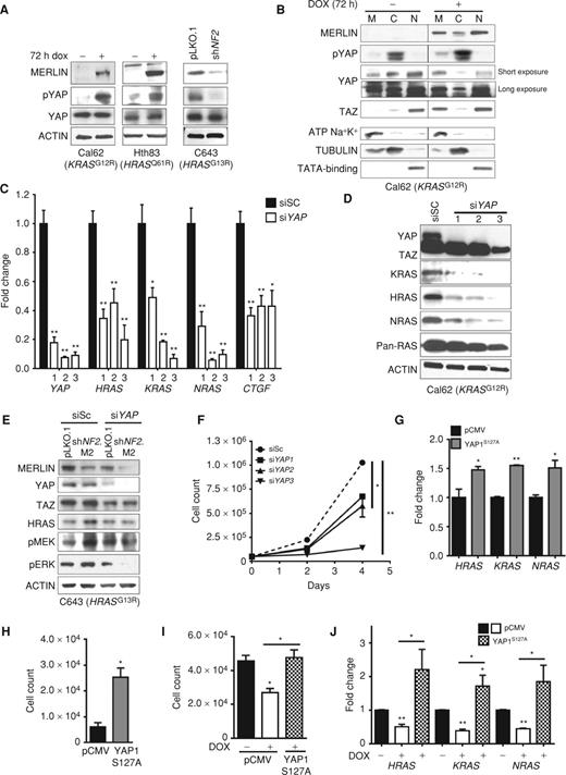 NF2 Loss Promotes Oncogenic RAS-Induced Thyroid Cancers via YAP ...