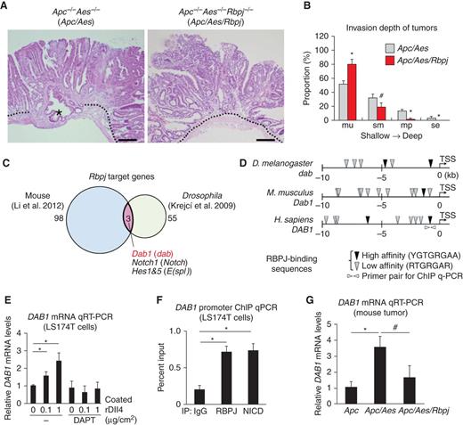 Promotion of Colorectal Cancer Invasion and Metastasis through ...