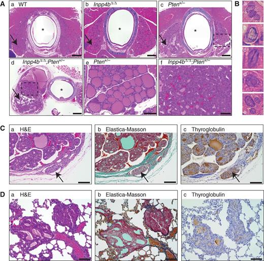 INPP4B Is a PtdIns(3,4,5)P3 Phosphatase That Can Act as a Tumor ...