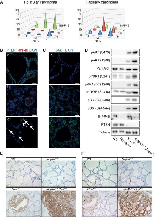 INPP4B Is a PtdIns(3,4,5)P3 Phosphatase That Can Act as a Tumor ...