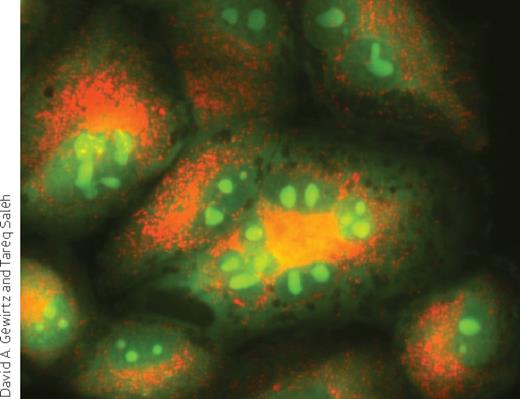 Nobel Prize Honors Autophagy Discovery | Cancer Discovery | American ...