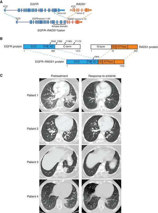 EGFR Fusions as Novel Therapeutic Targets in Lung Cancer | Cancer ...