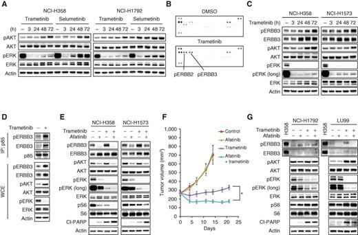 Epithelial-to-Mesenchymal Transition Defines Feedback Activation of ...