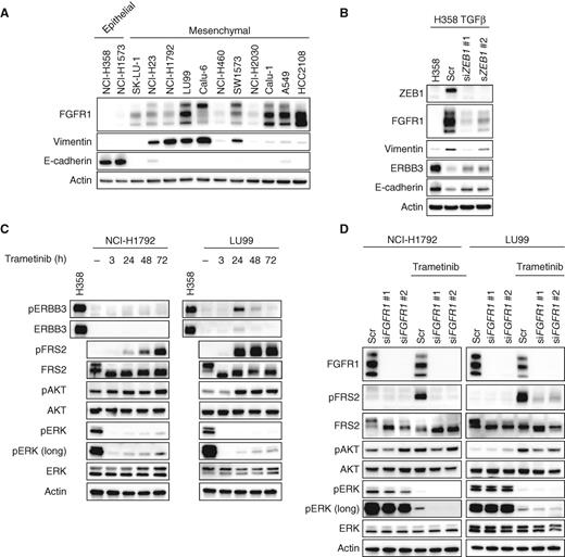 Epithelial-to-Mesenchymal Transition Defines Feedback Activation of ...