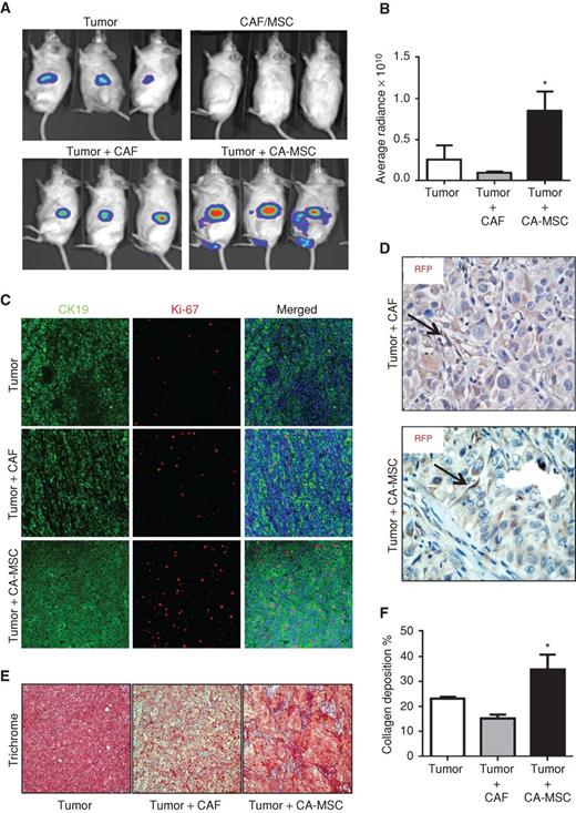 GM-CSF Mediates Mesenchymal–Epithelial Cross-talk in Pancreatic Cancer ...