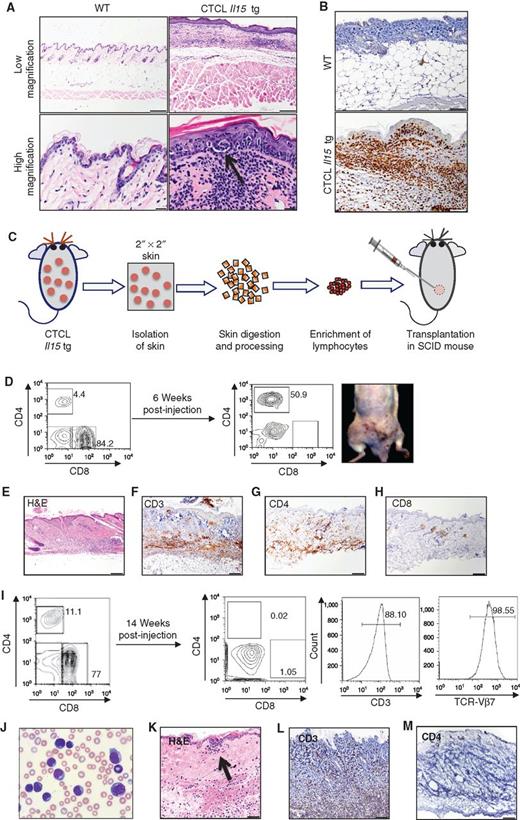 Mechanism, Consequences, and Therapeutic Targeting of Abnormal IL15 ...