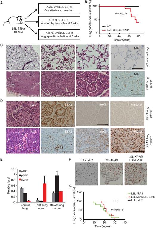 Oncogenic Deregulation of EZH2 as an Opportunity for Targeted Therapy ...