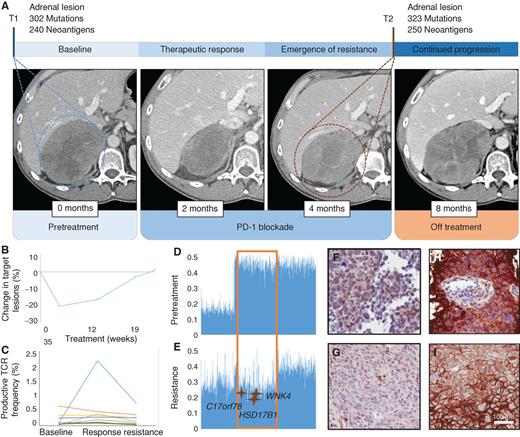 Evolution of Neoantigen Landscape during Immune Checkpoint Blockade in ...