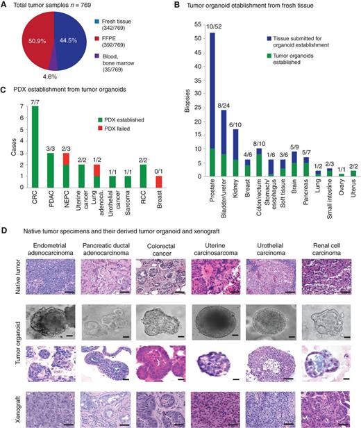 Personalized In Vitro and In Vivo Cancer Models to Guide Precision ...