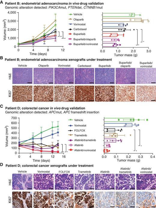 Personalized In Vitro and In Vivo Cancer Models to Guide Precision ...