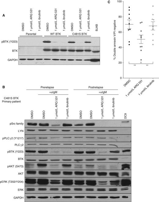The BTK Inhibitor ARQ 531 Targets Ibrutinib-Resistant CLL and Richter ...