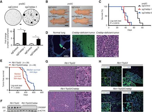 Crebbp Loss Drives Small Cell Lung Cancer and Increases Sensitivity to ...