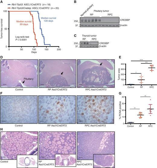 Crebbp Loss Drives Small Cell Lung Cancer and Increases Sensitivity to ...