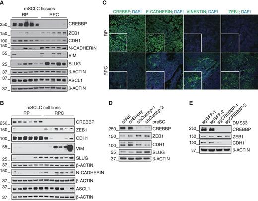 Crebbp Loss Drives Small Cell Lung Cancer and Increases Sensitivity to ...